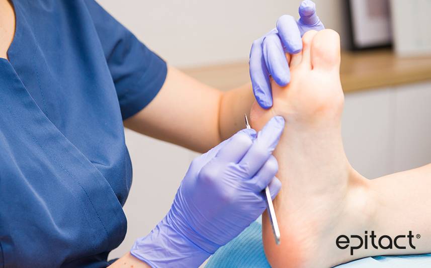 Traitement du cor au pied et de l’œil-de-perdrix